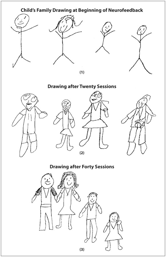 Two studies aim to bring funding and attention to neurofeedback in the ...